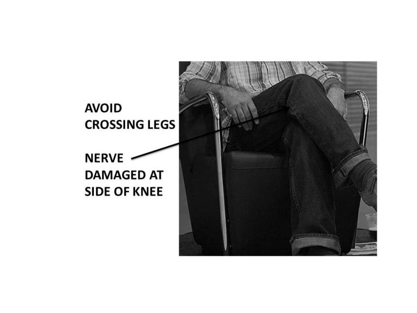 Peroneal Neuropathy at the Fibular Head (Foot drop) – Neuromuscular and ...
