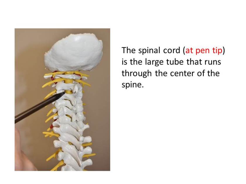 Cervical Myelopathy (spinal cord compression) – Neuromuscular and ...