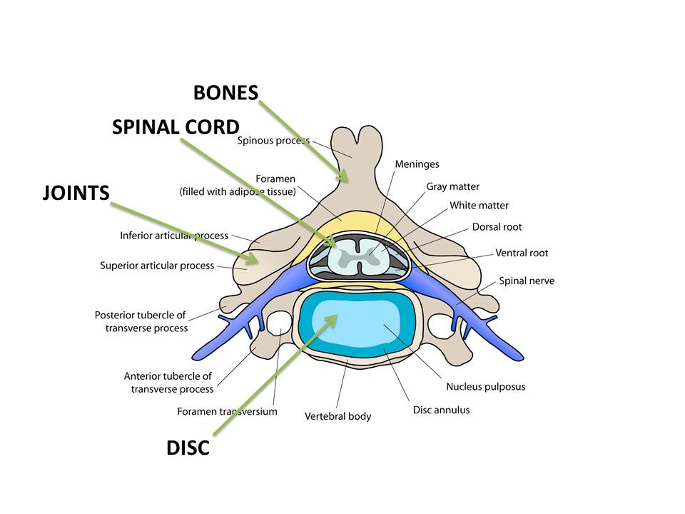Cervical Myelopathy (spinal cord compression) – Neuromuscular and ...