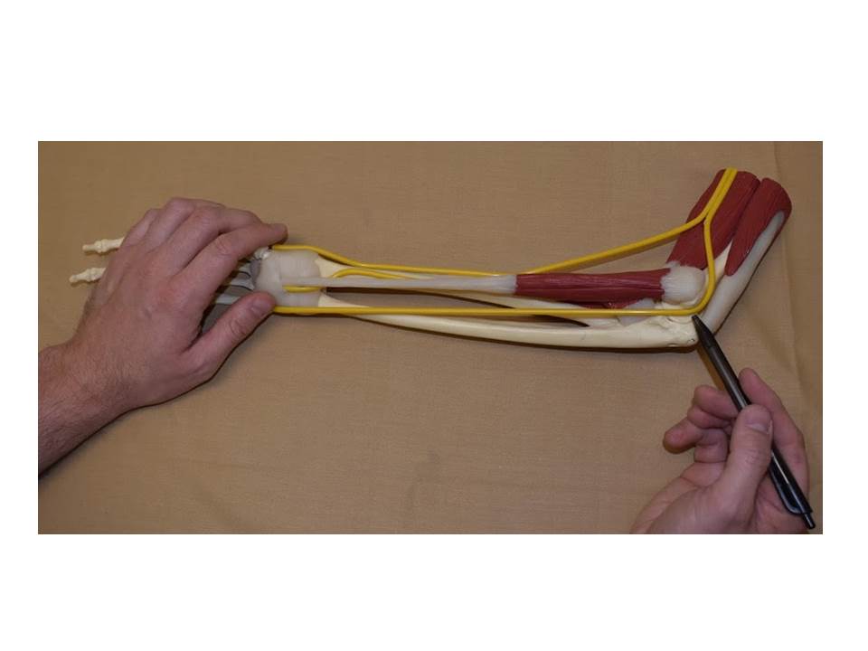 Ulnar Neuropathy at the Elbow (Cubital Tunnel Syndrome) – Neuromuscular ...